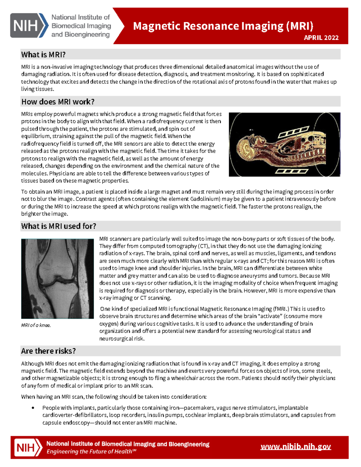 Fact Sheet Magnetic Resonance Imaging MRI - m~ National Institute of ...