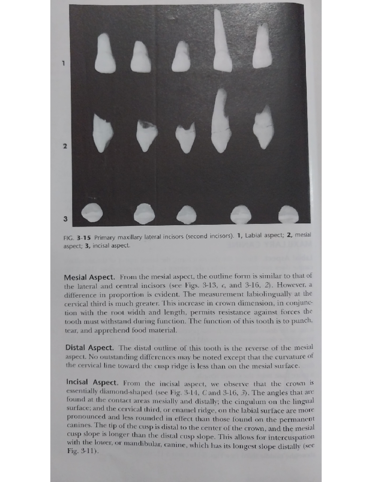 20221113 191648 - Pulp chambers and pulp canals - Dental school - Studocu