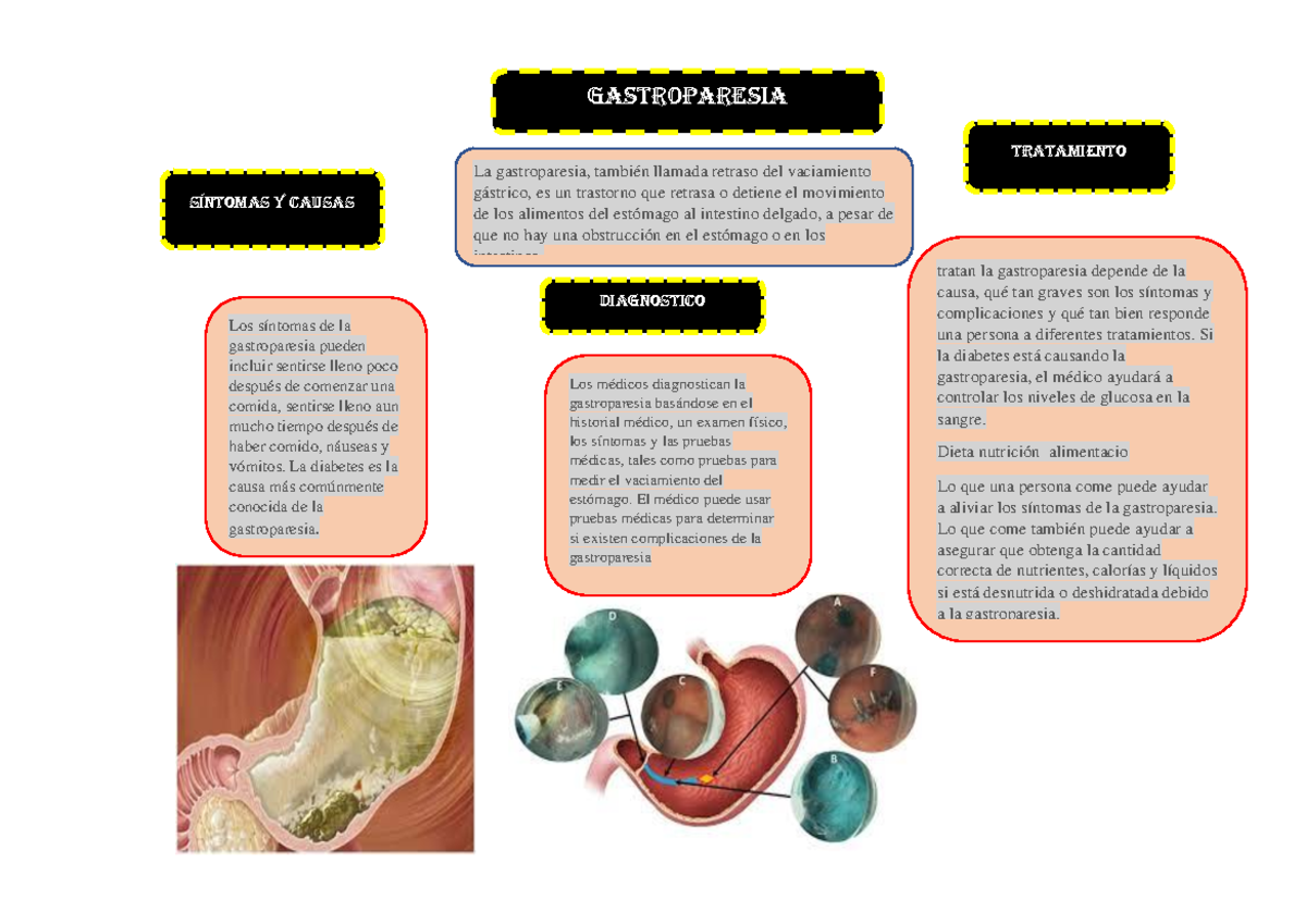 Mapas de fisiopatolofia - GASTROPARESIA Los médicos diagnostican la ...
