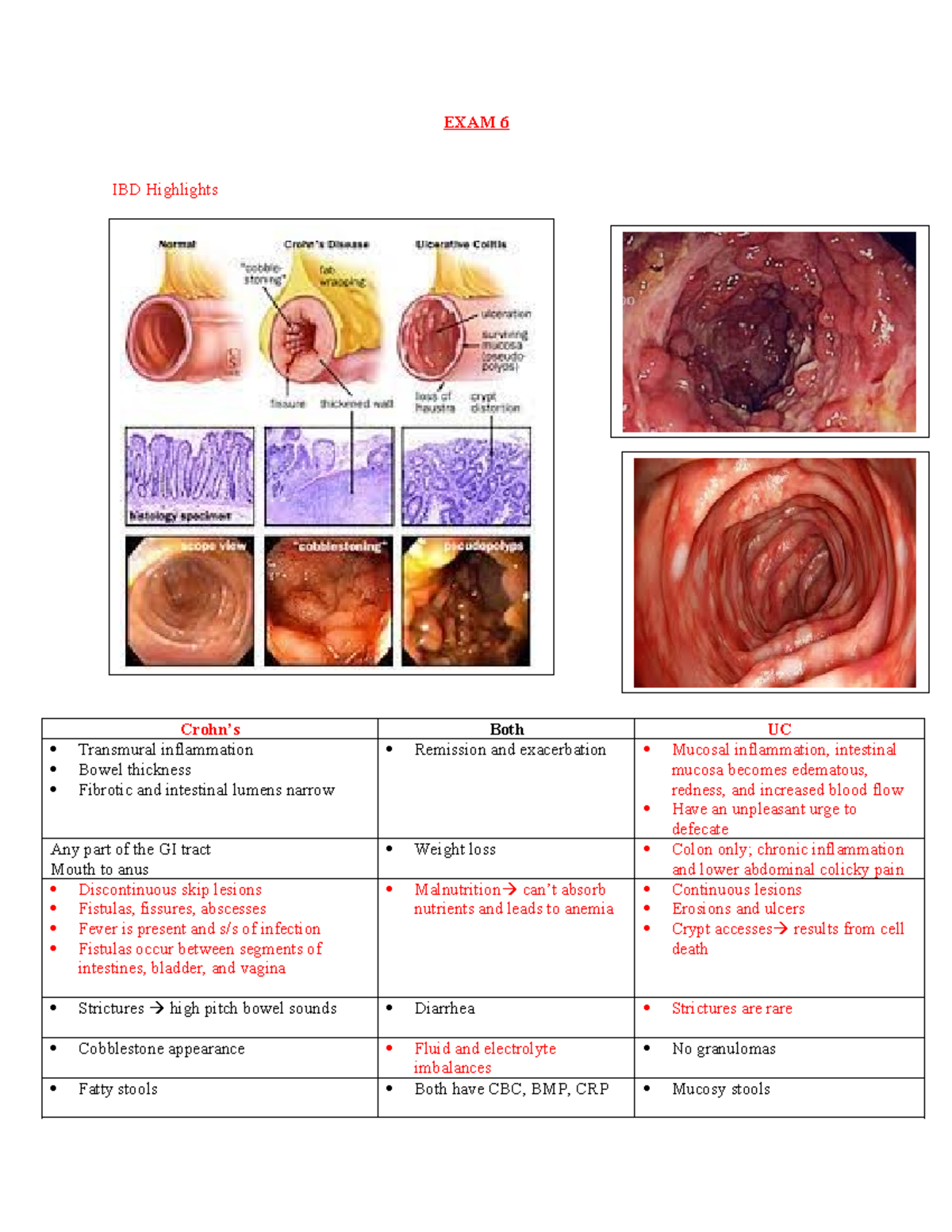 Exam6 - practice questions - EXAM 6 IBD Highlights Crohn’s Both UC ...