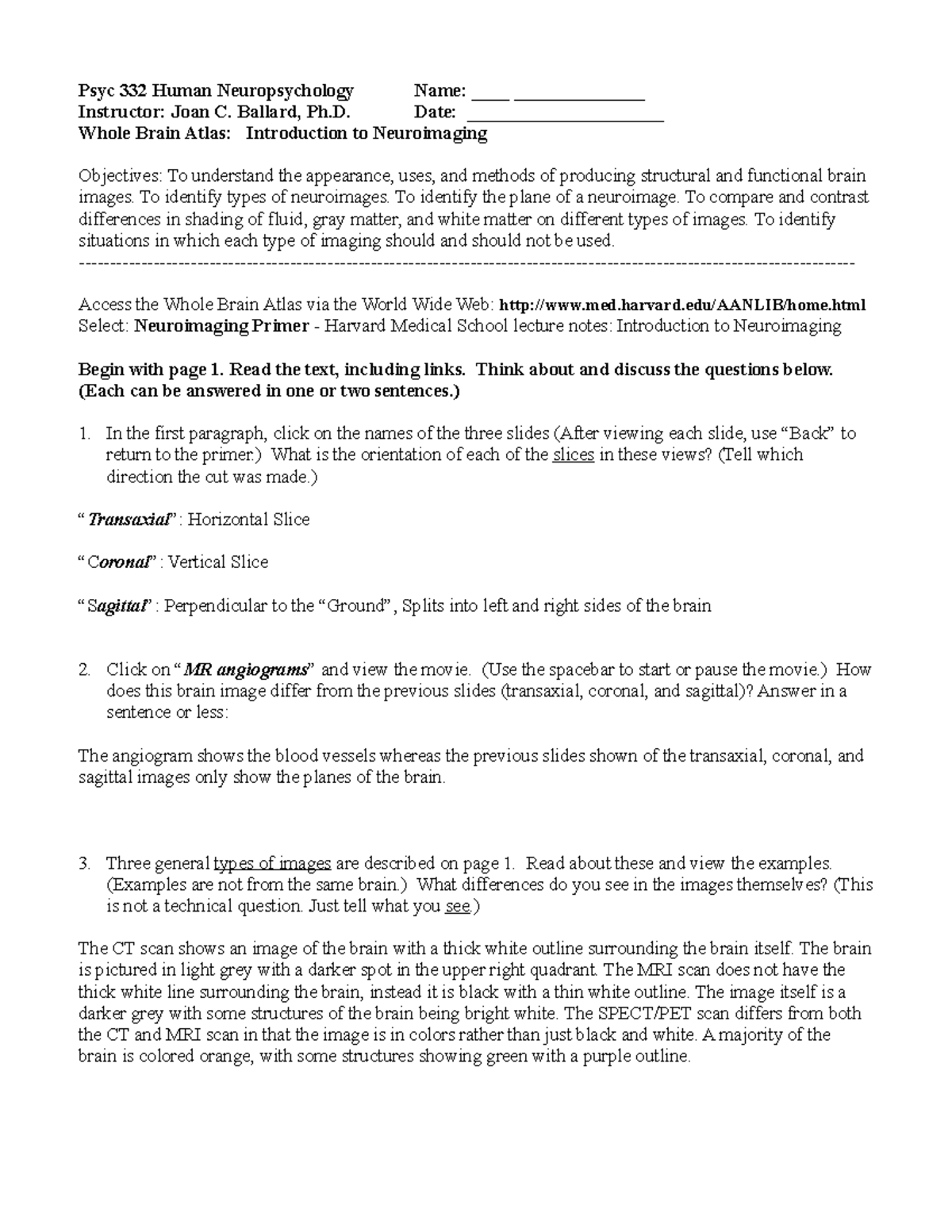 Neuropsych lab 7 - lab 7 - Psyc 332 Human Neuropsychology Name ...