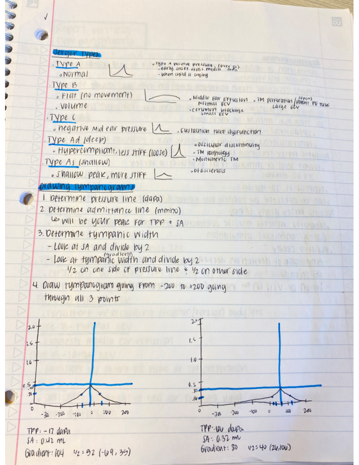 IMG 7660 - classifying jerger types and how to draw a tympanogram - CDI ...
