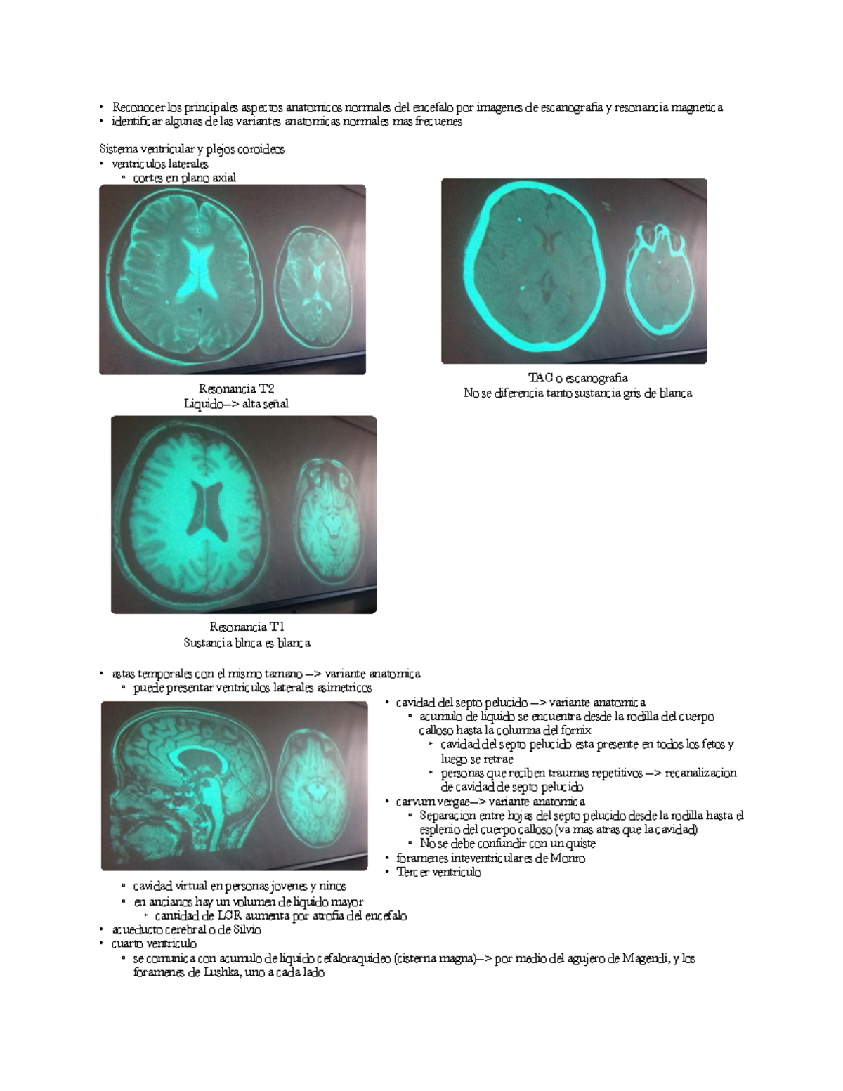 2. Imagenes normales SNC - • Reconocer los principales aspectos ...
