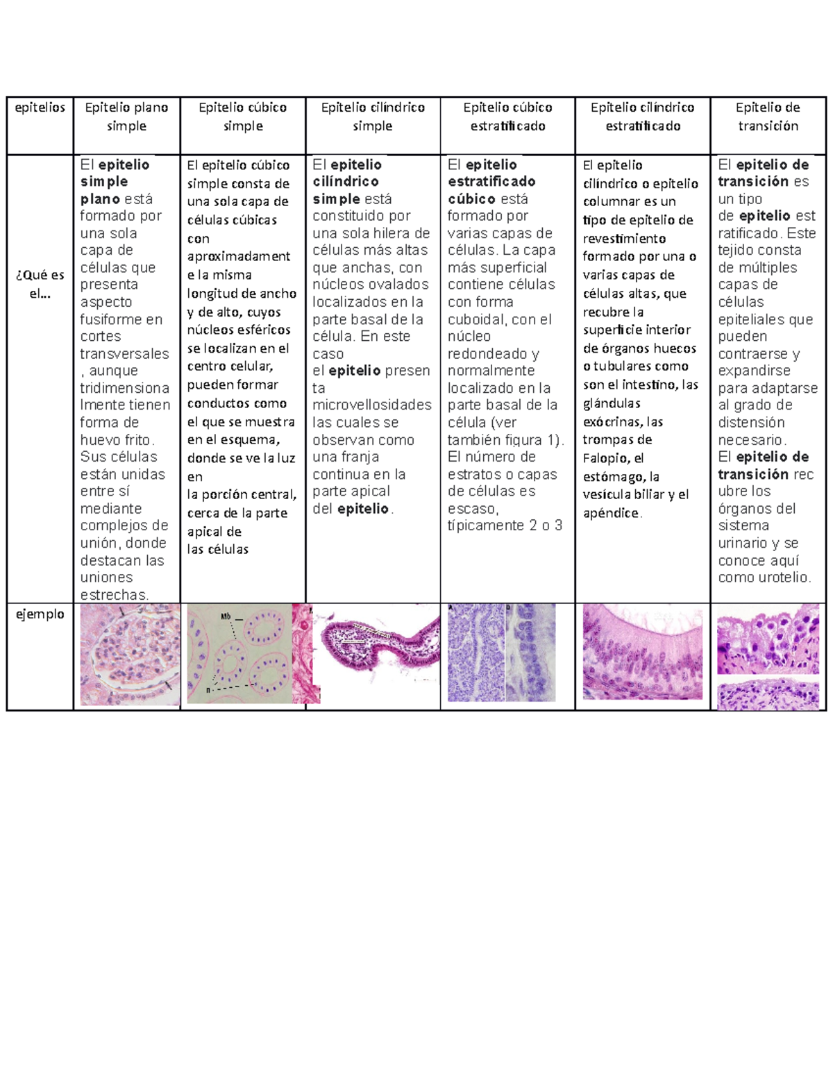 Epitelios cortes de histologia - epitelios Epitelio plano simple ...