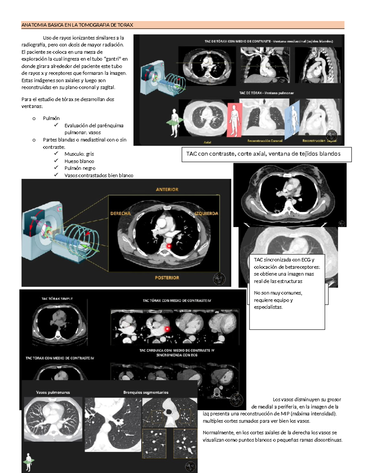 Anatomia Tomografica DE Torax - ANATOMIA BASICA EN LA TOMOGRAFIA DE ...