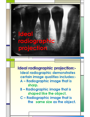 X –Ray films - Dental Radiology - X – Ray films Radiograph: - Is a ...