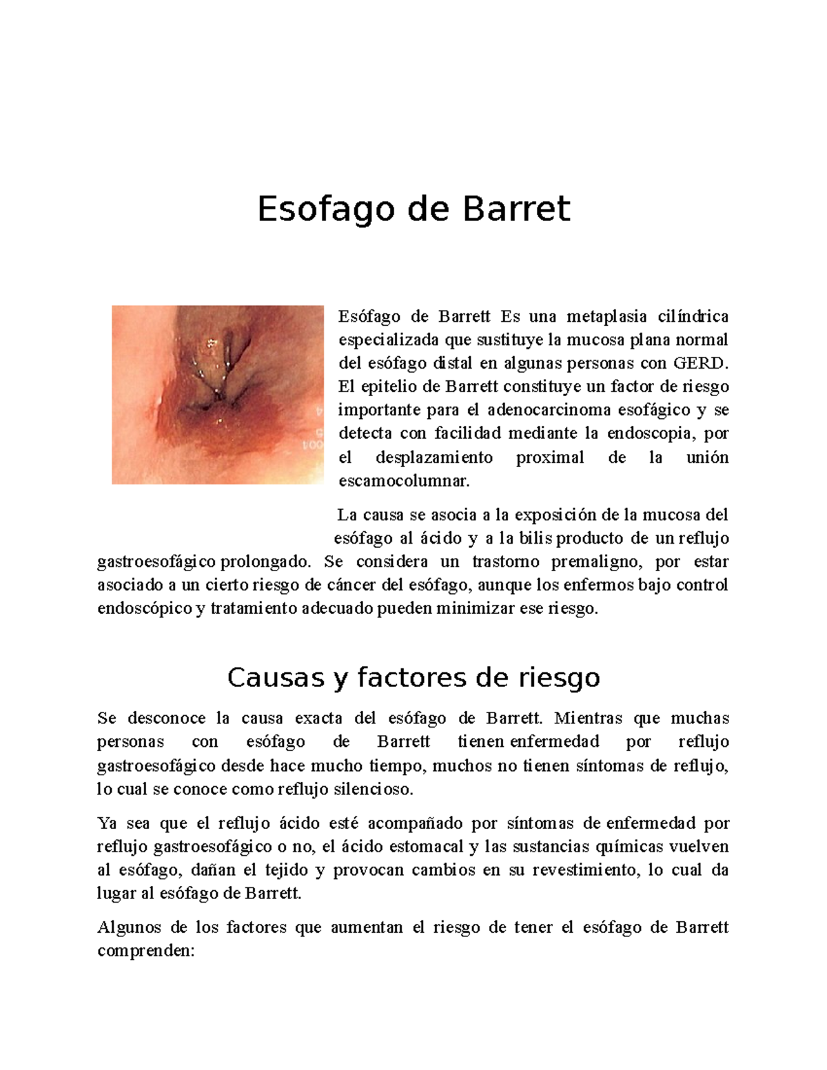 Esofago de barret - Esofago de Barret Esófago de Barrett Es una ...