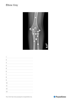 Lower limb worksheet - Name: Class: Date: ID: A C6 Lower Limb Worksheet ...