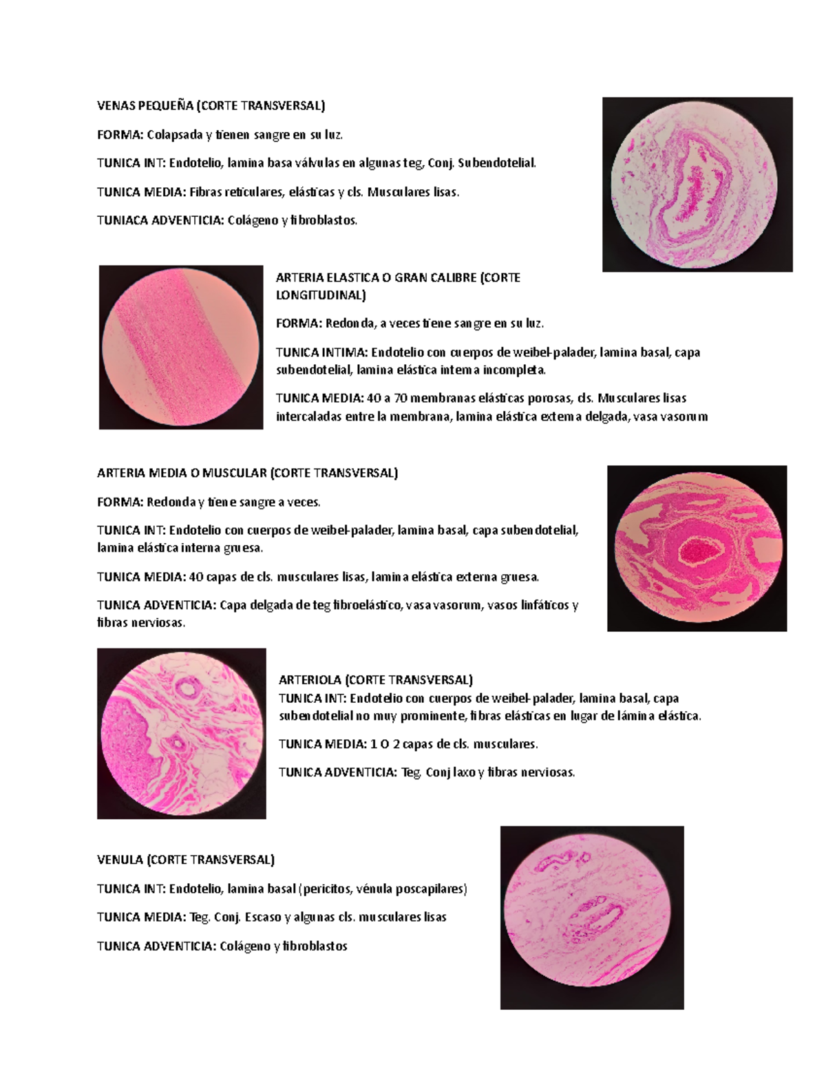 Laminas DE Histo - VENAS PEQUEÑA (CORTE TRANSVERSAL) FORMA: Colapsada y ...