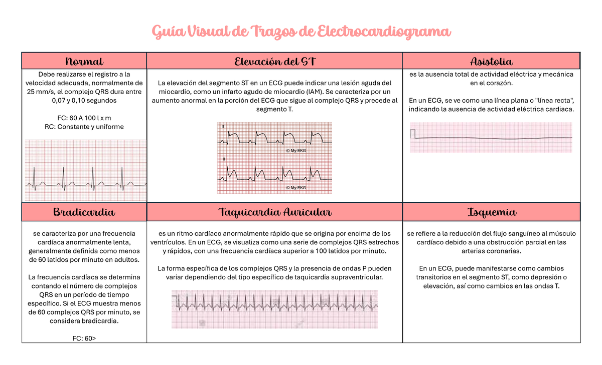 Guia Visual de trazos de Electrocardiograma - Guía Visual de Trazos de ...