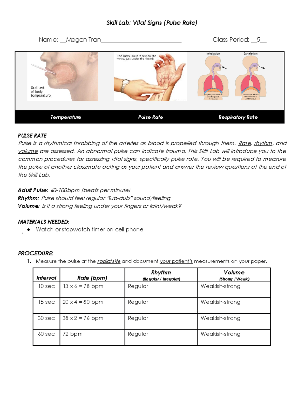 Skill LAB Pulse RATE - Skill Lab: Vital Signs (Pulse Rate) Name: Megan ...