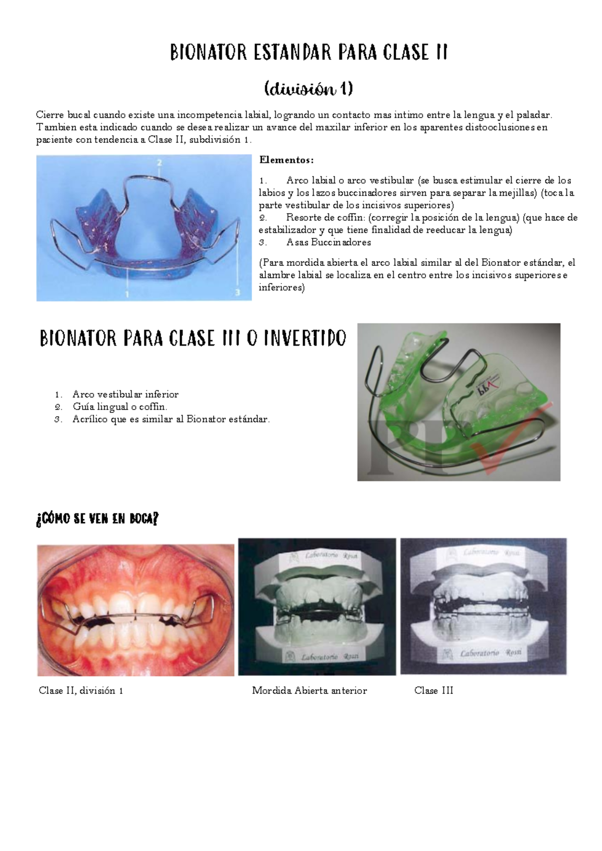 Aparato DE Bionator - BIONATOR ESTANDAR PARA CLASE II (división 1 ...