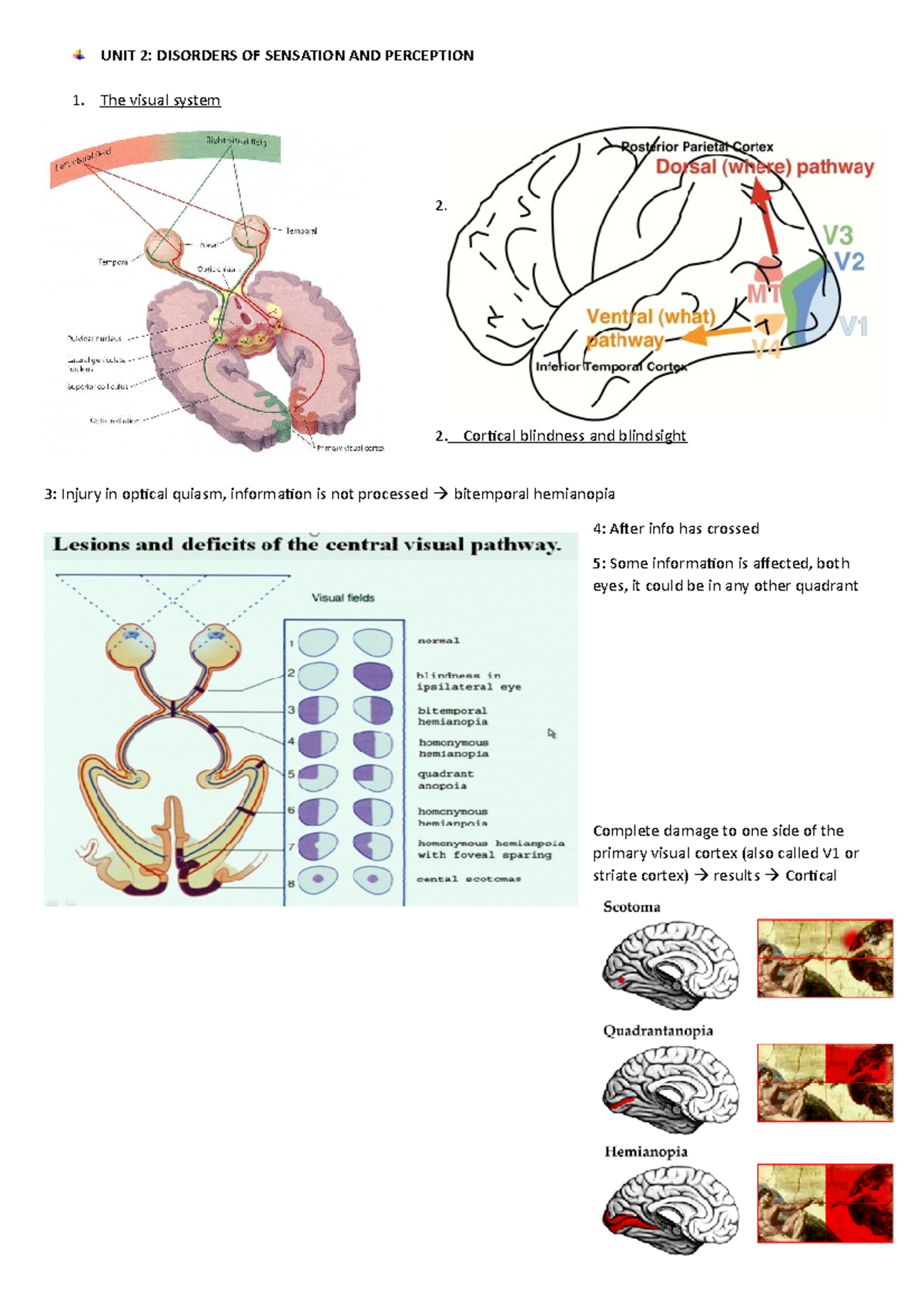 Sensation and perception - UNIT 2: DISORDERS OF SENSATION AND ...