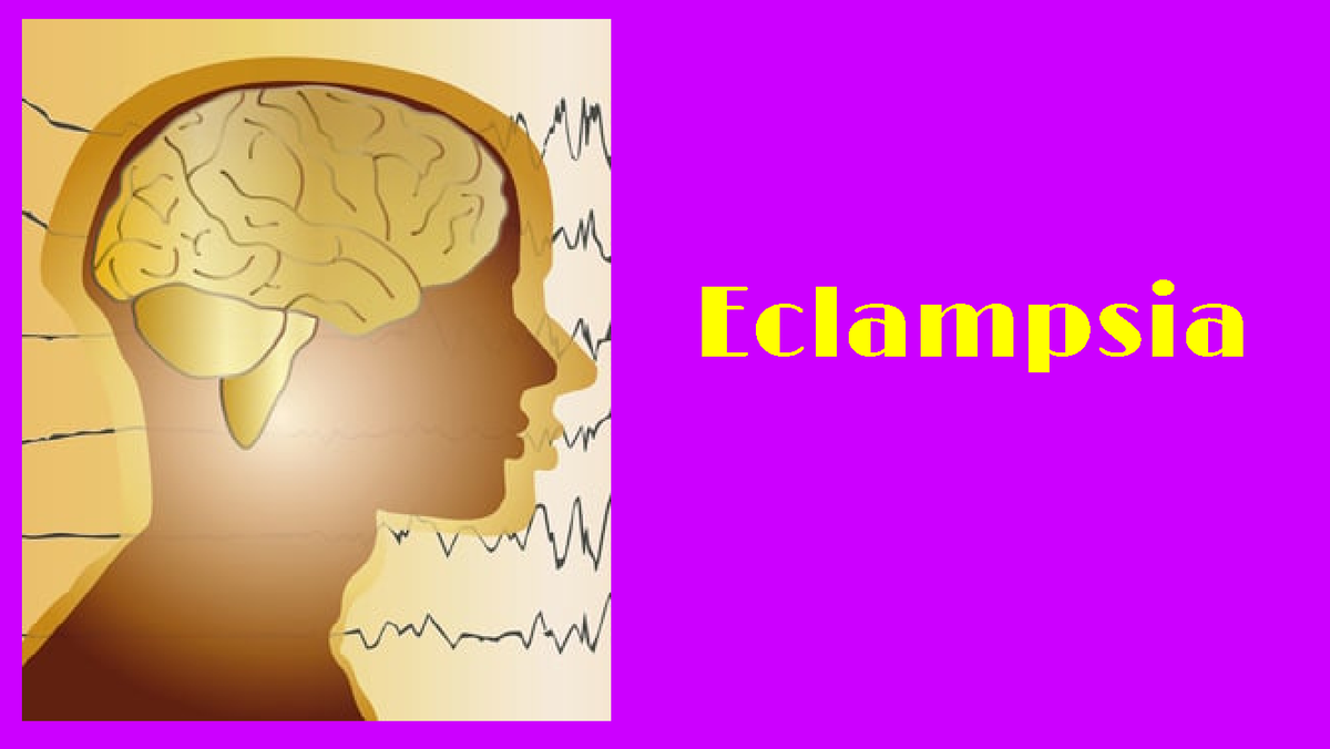 Eclampsia - Apuntes - Eclampsia La eclampsia es una enfermedad que ...