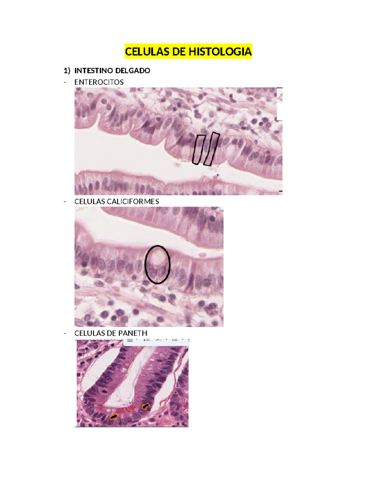 Celulas DE Histologia - CELULAS DE HISTOLOGIA 1) INTESTINO DELGADO ...
