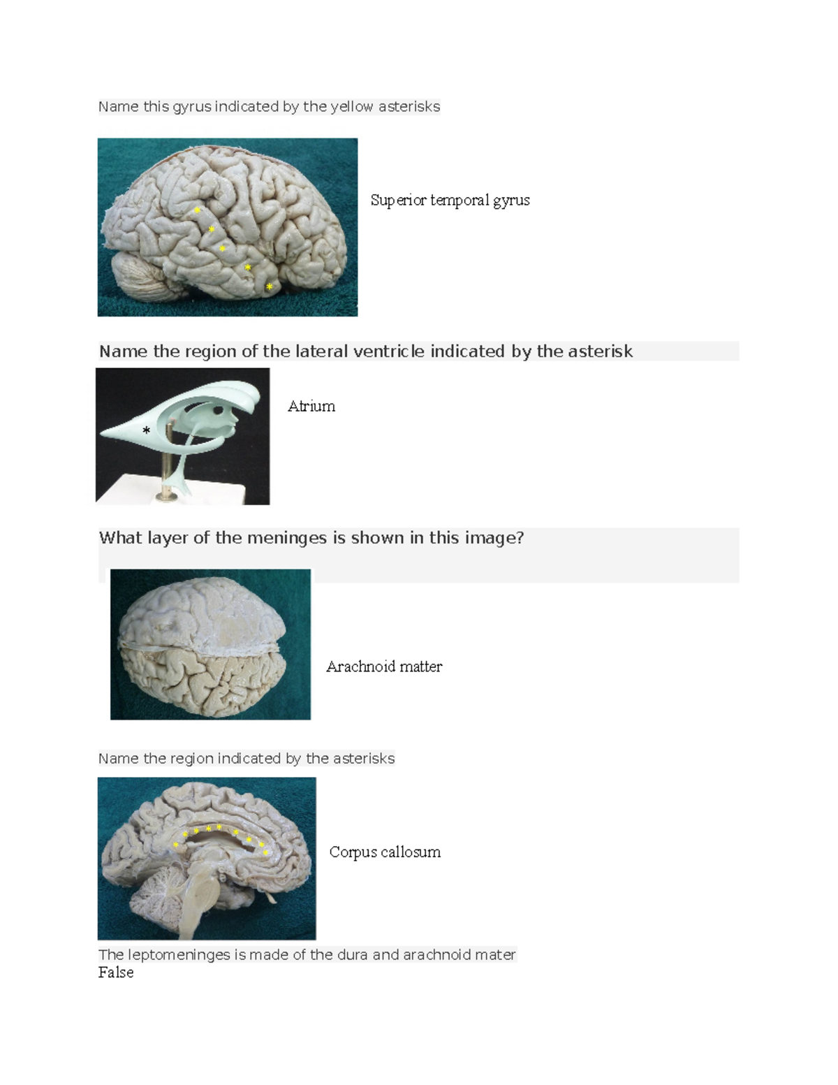 Neuro opal questions and answers - Name this gyrus indicated by the ...
