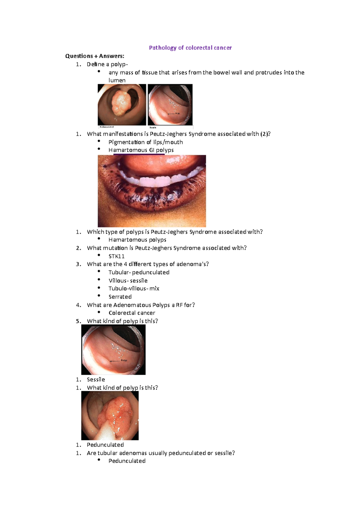 Pathology of colorectal cancer - Pathology of colorectal cancer ...