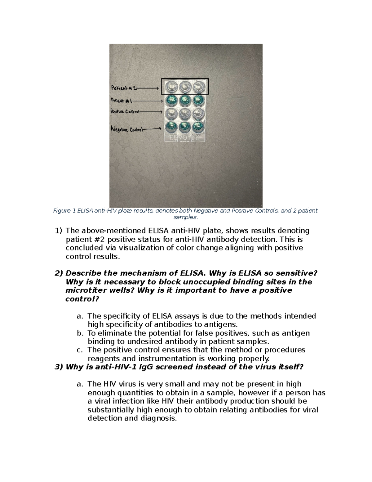 Lab7 - Figure 1 ELISA anti-HIV plate results, denotes both Negative and ...