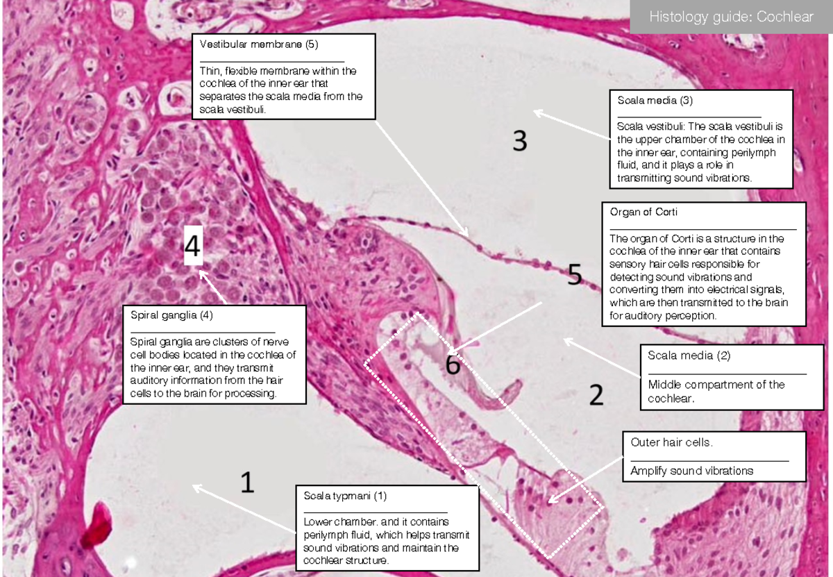 ANAT3009 Ear Histology - Scala typmani (1) ___________________________ Lower chamber. and it ...