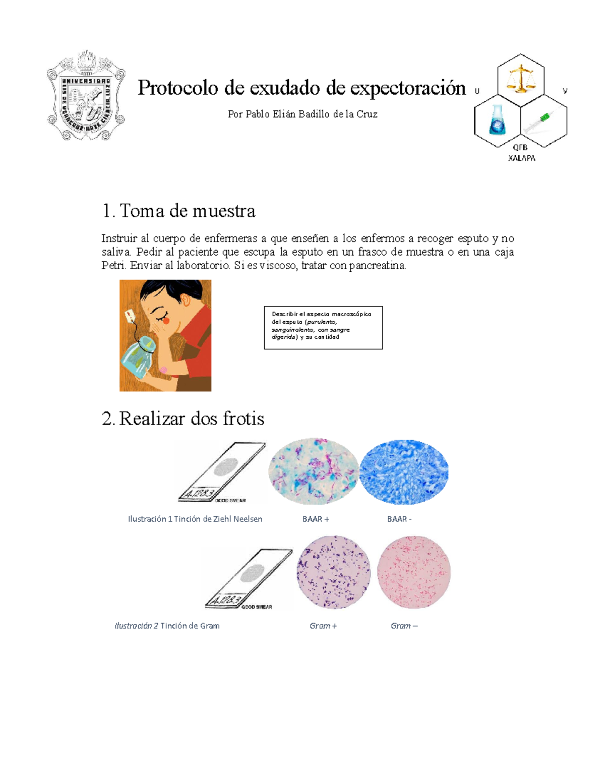 Protocolo de exudado de expectoración - Protocolo de exudado de ...