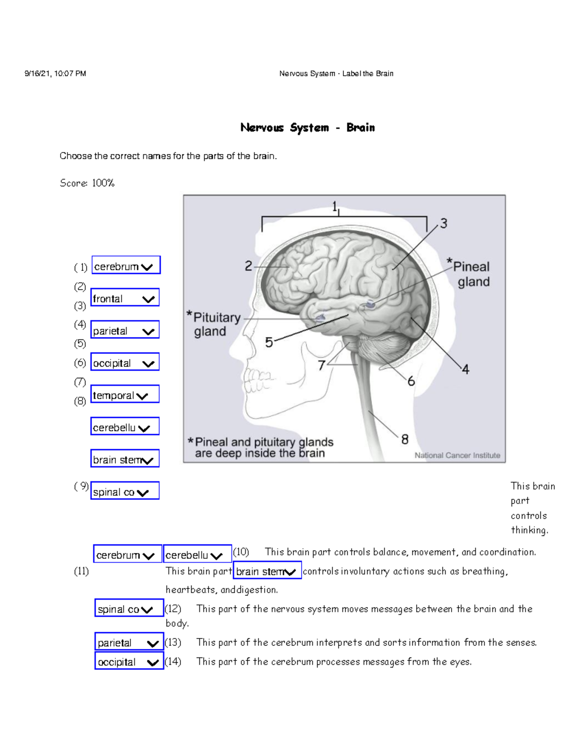 Nervous System - Label the Brain - 9/16/21, 10:07 PM Nervous System ...