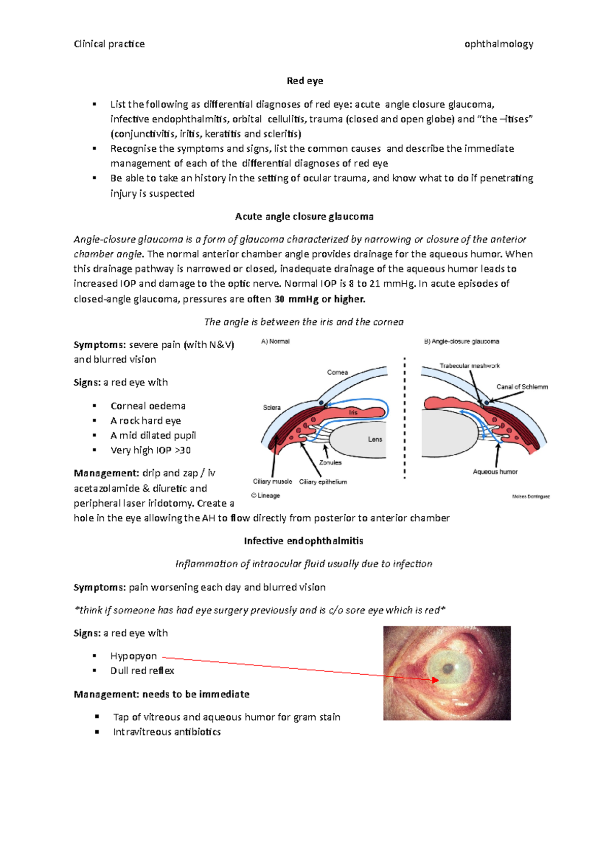 Red eye - Causes of Red Eye with specific signs and symptoms ...