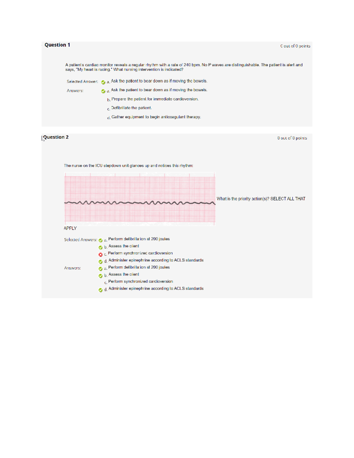 Med Surge III ECG Assignment answers - Copy - NUR 415 - Studocu