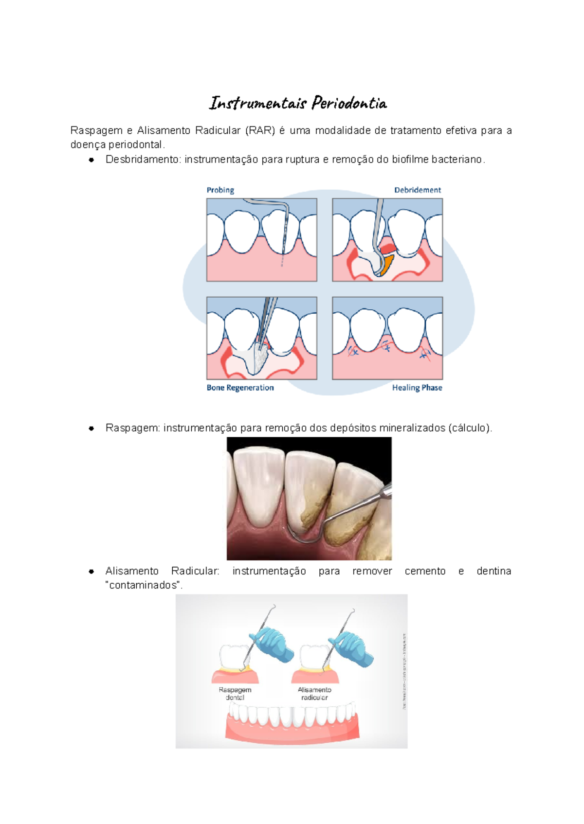 Resumoprovadeperiop 1 - Inruti Perot Raspagem e Alisamento Radicular (RAR) é uma modalidade de ...