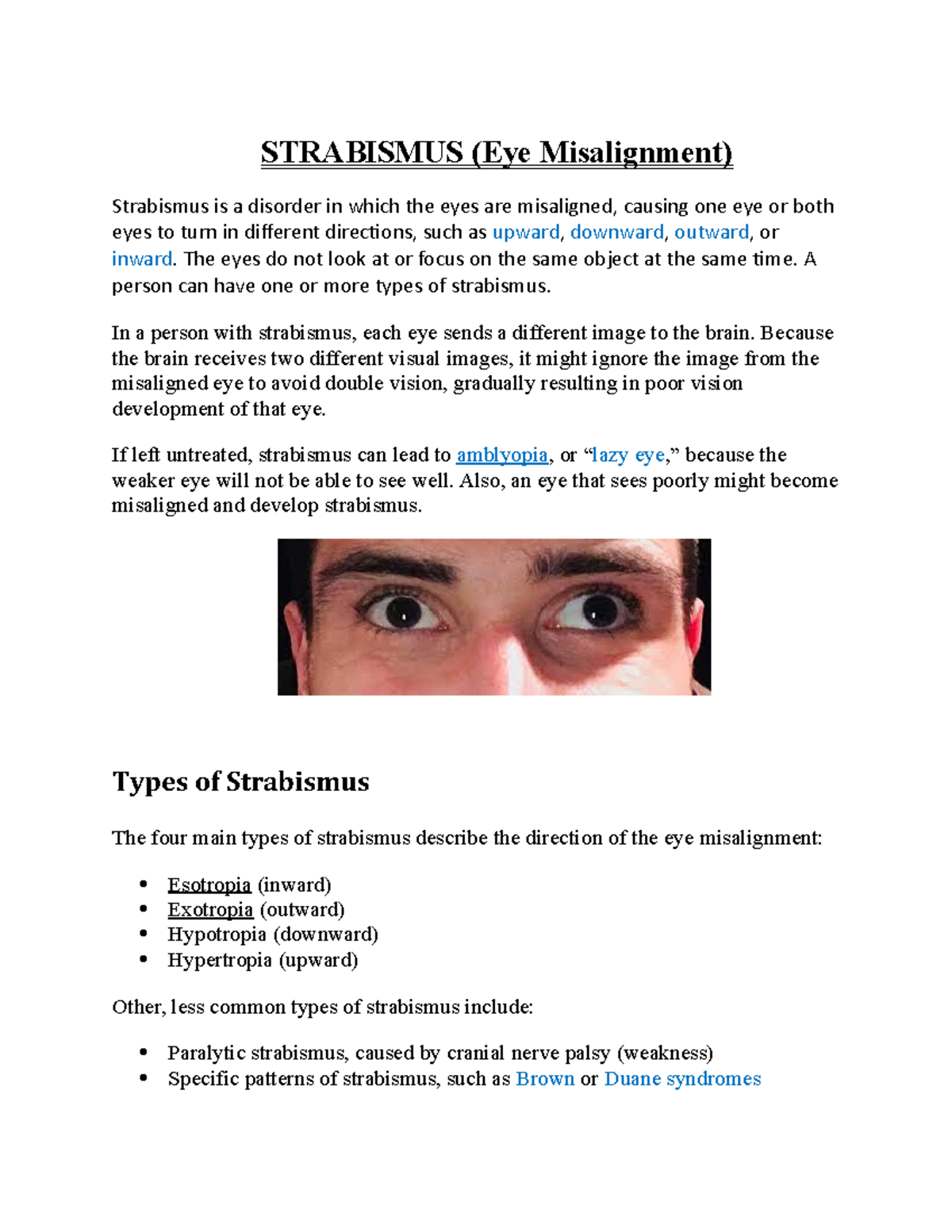 Strabismus - Lecture notes - STRABISMUS (Eye Misalignment) Strabismus ...