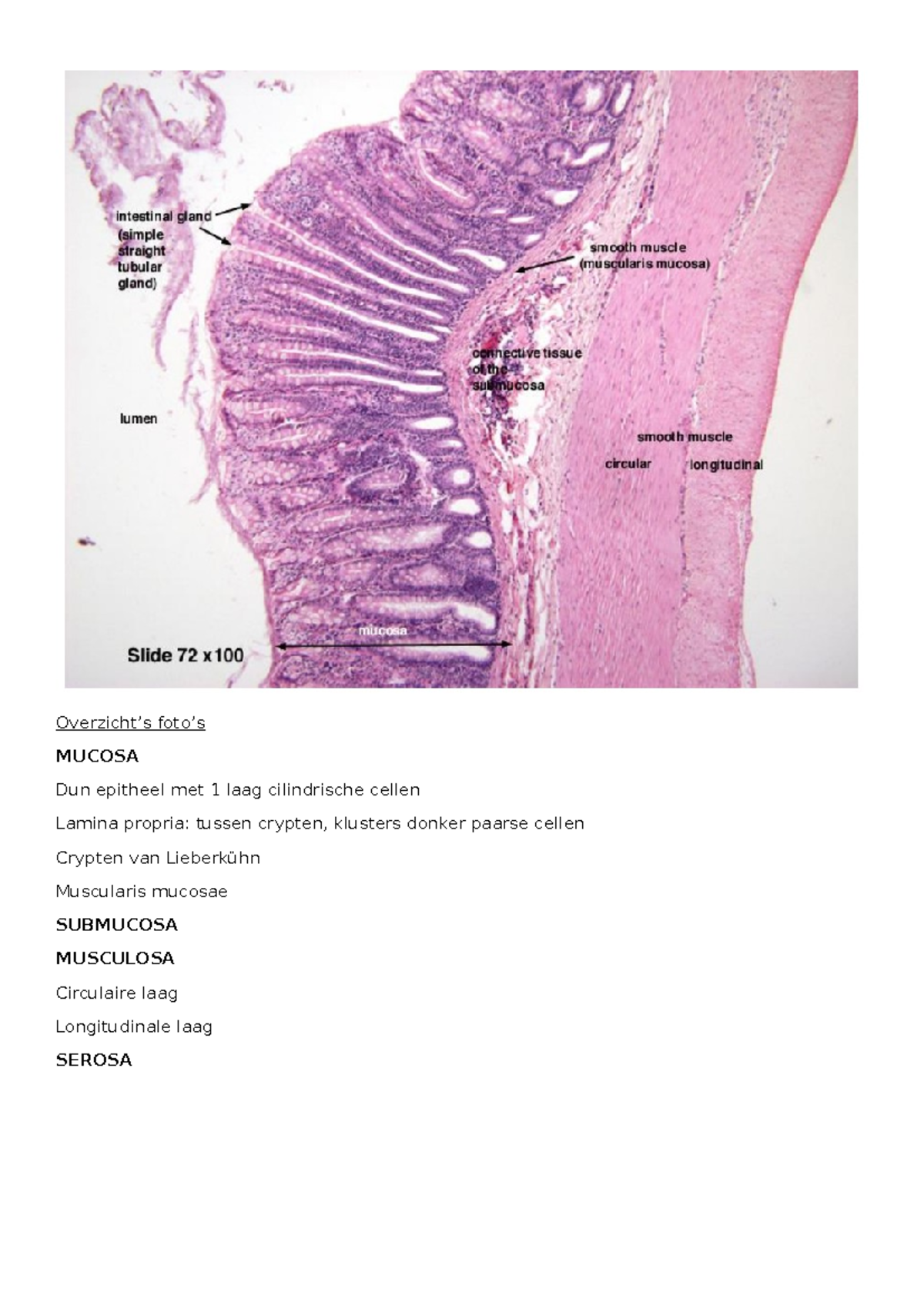Overzicht darm - tekening - Histologie - Overzicht’s foto’s MUCOSA Dun ...