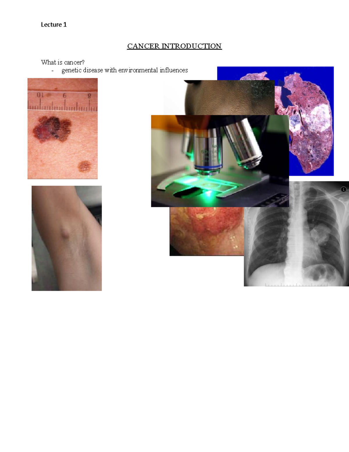 Lecture 1: cancer introduction - CANCER INTRODUCTION What is cancer ...