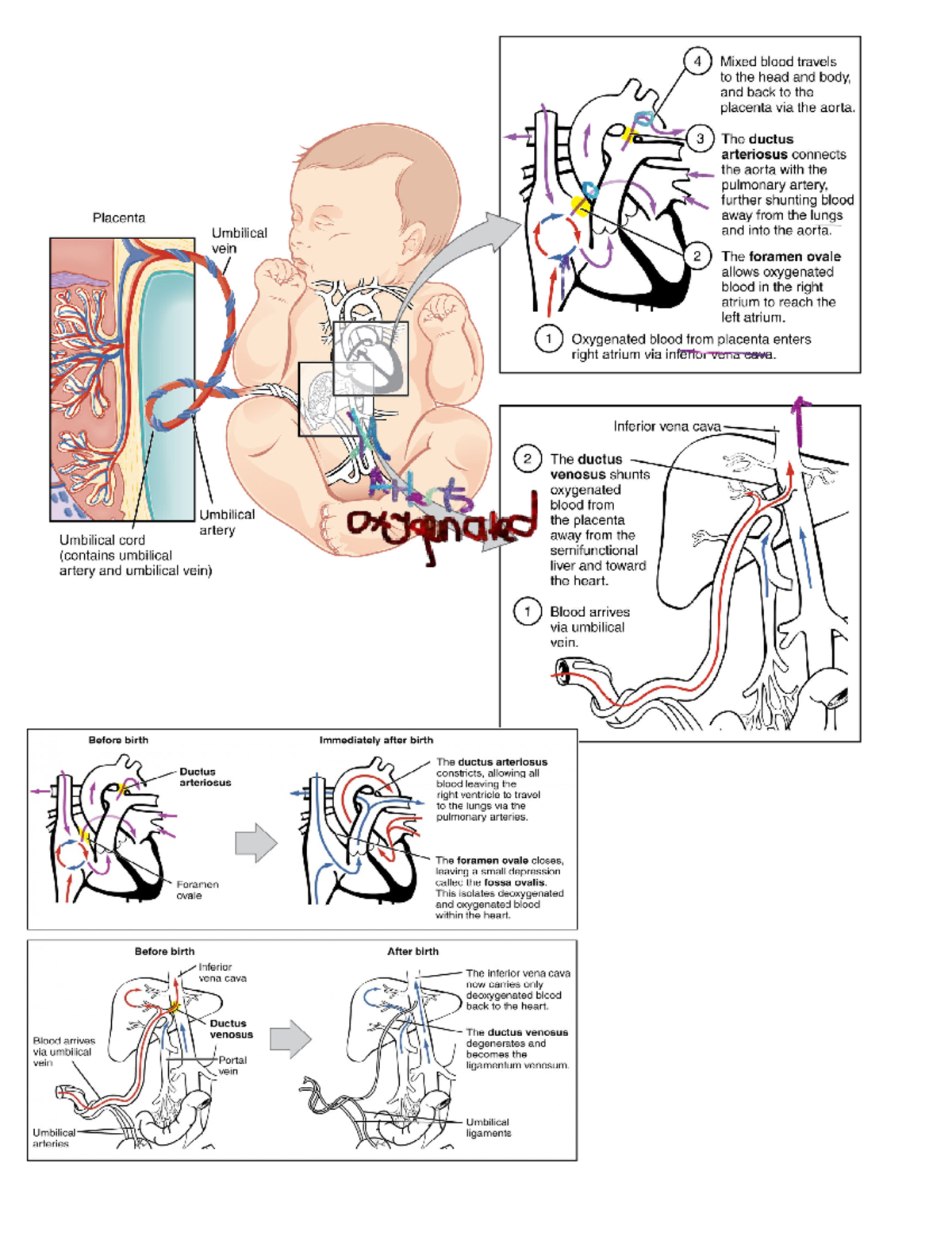 Peds heart images to help - NUR 211 - Studocu