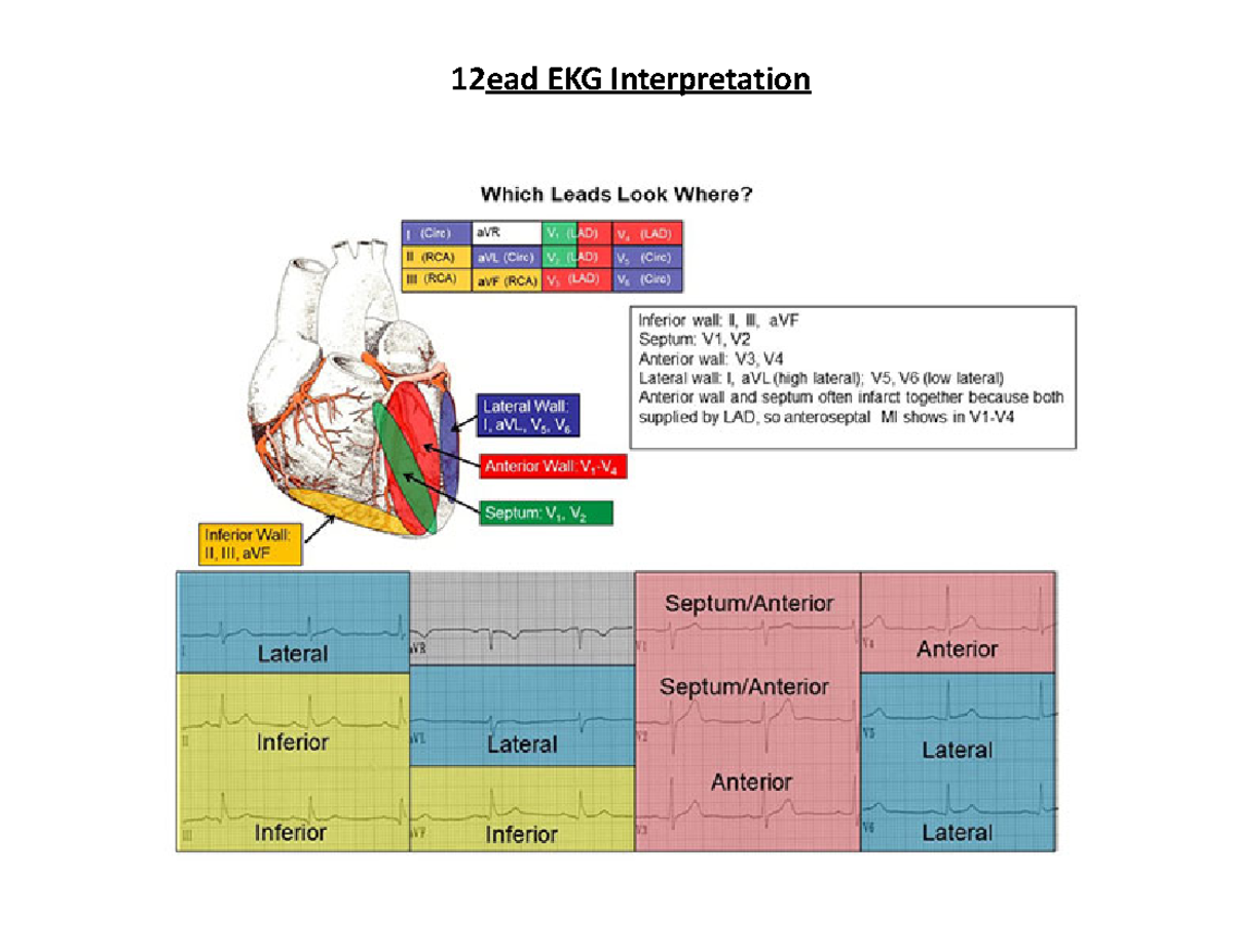 12 Lead EKG - 12 lead - 12 ead EKG Interpretation 1.) Anterior Lateral ...