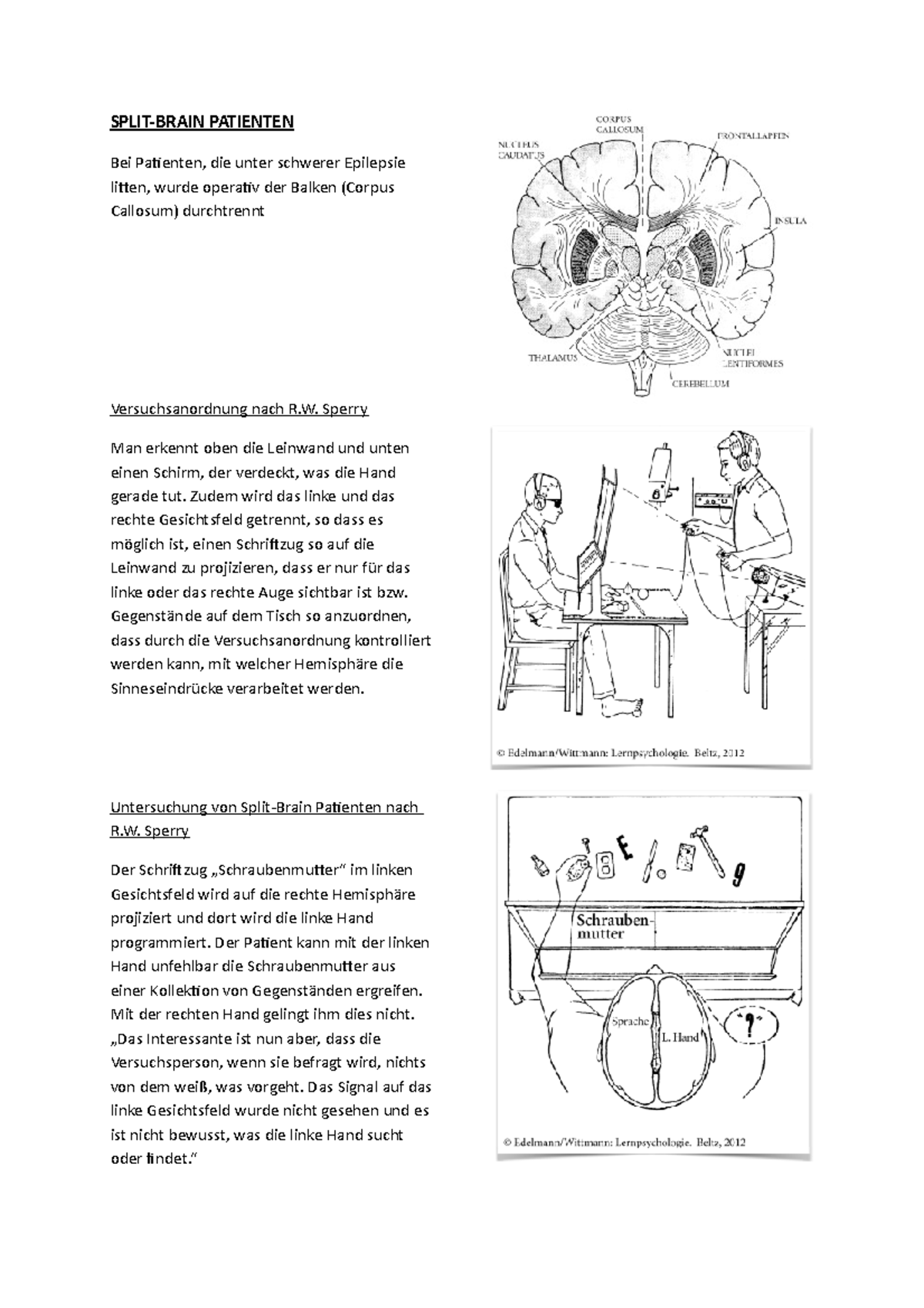 Split brain patients - SPLIT-BRAIN PATIENTEN Bei Patienten, die unter ...
