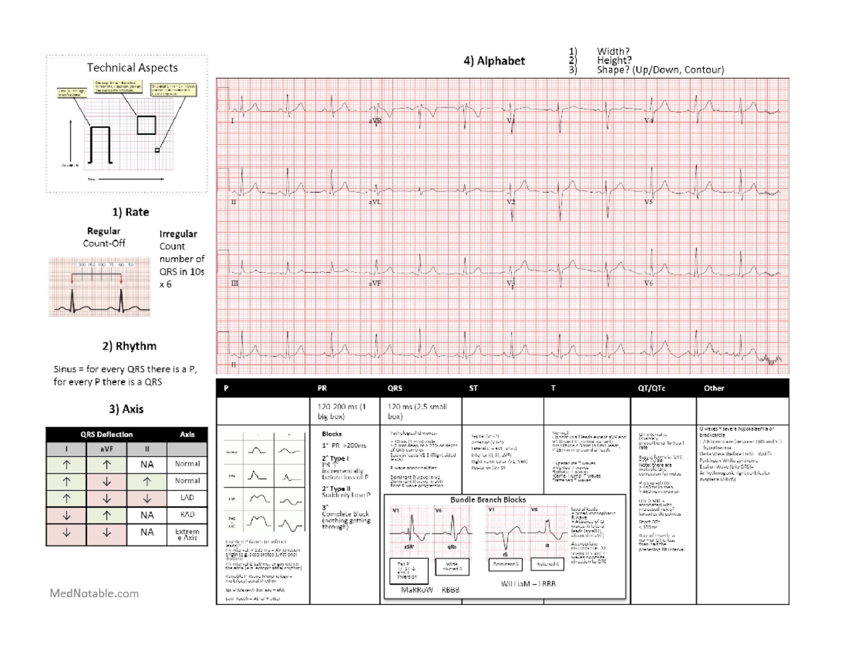 EKG Reading - EKG - NURS 210 - Studocu