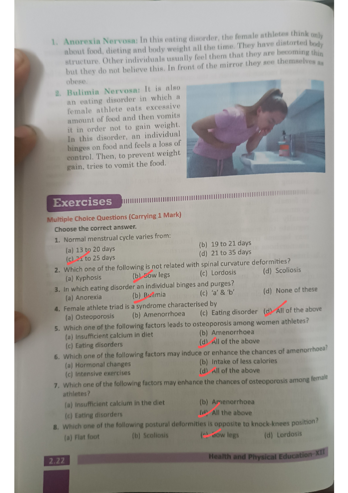Question of chapter 1 & 2 P. E copy copy - 1. Anorexia Nervosa: In this ...