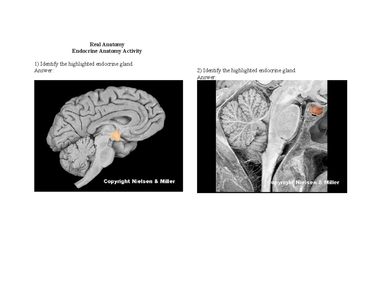 Endocrine System - Lab Assignment - Real Anatomy Endocrine Anatomy ...