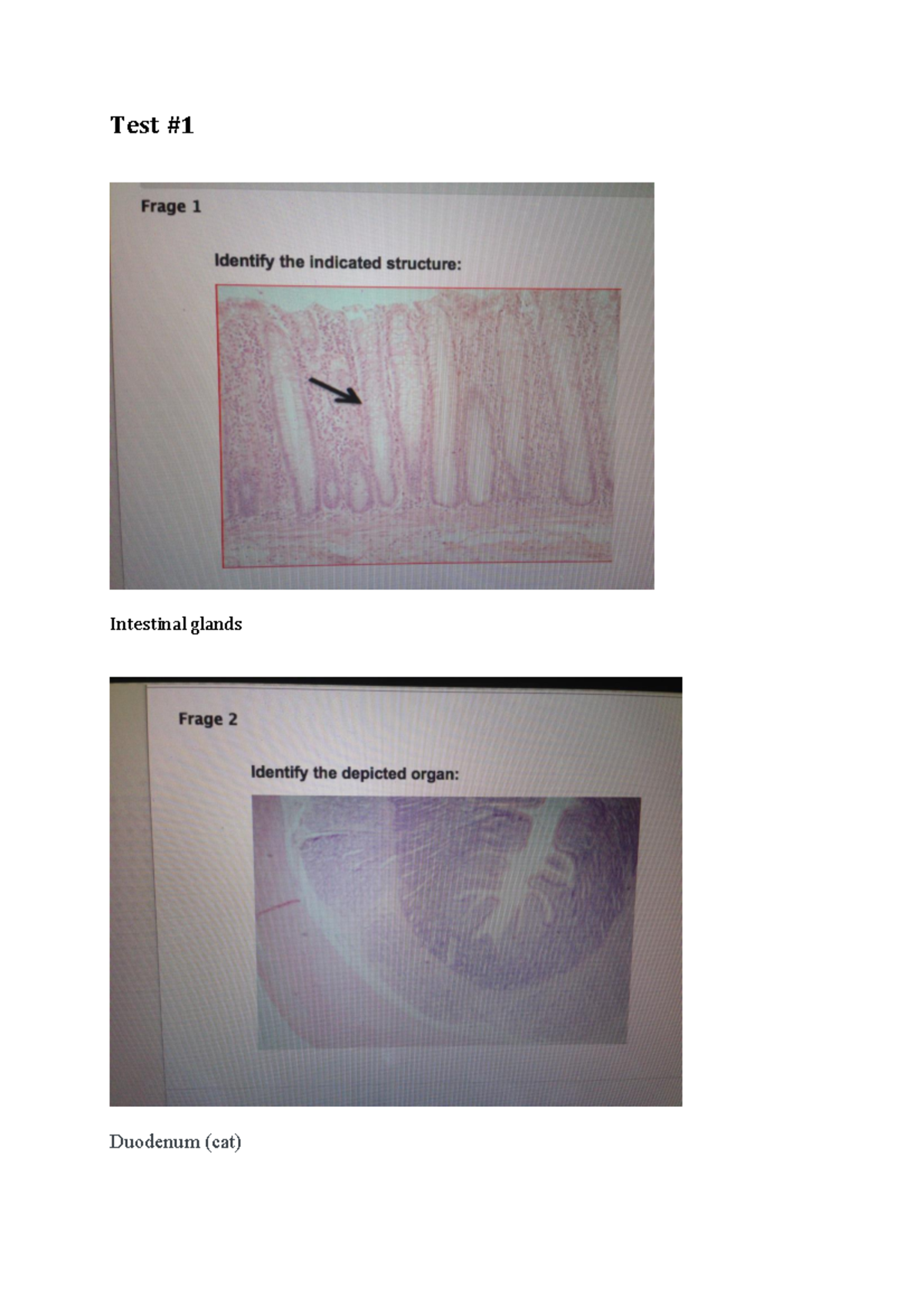 Anatomy Splancho test 3 - Test Intestinal glands Duodenum (cat) Isles ...