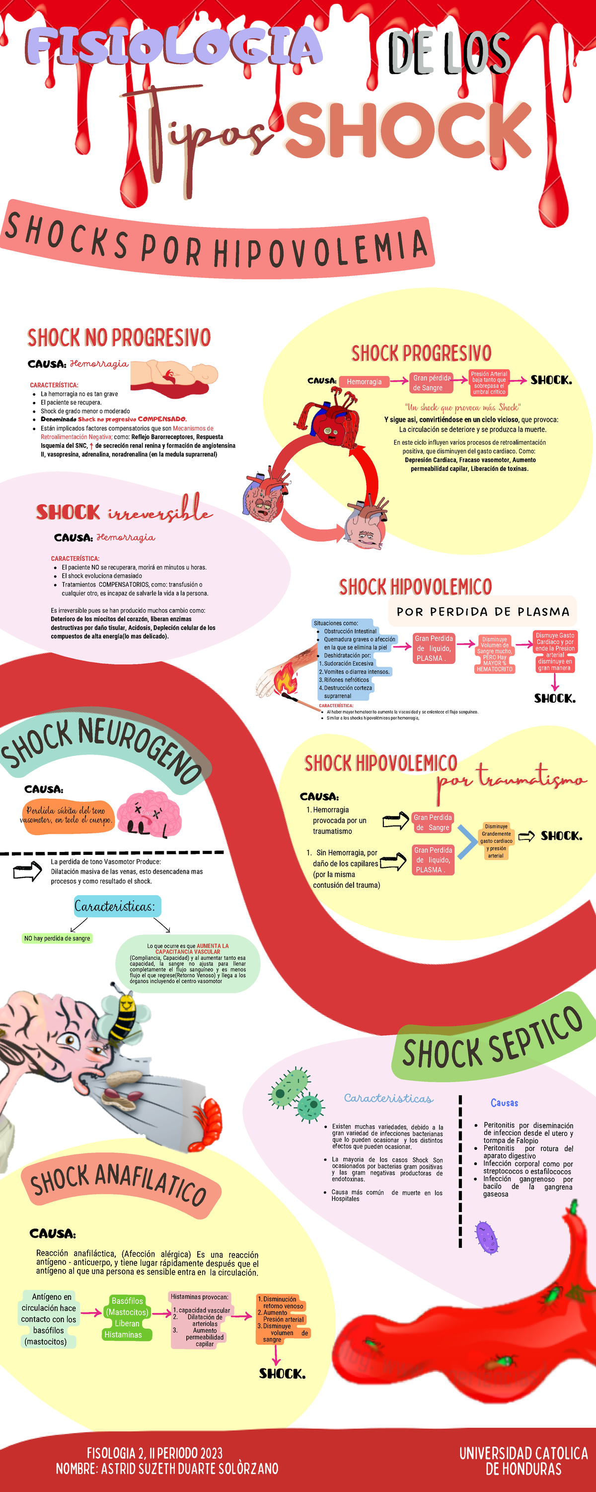 Infografia Tipos DE Shocks Fisio - Y sigue asi, convirtiéndose en un ...