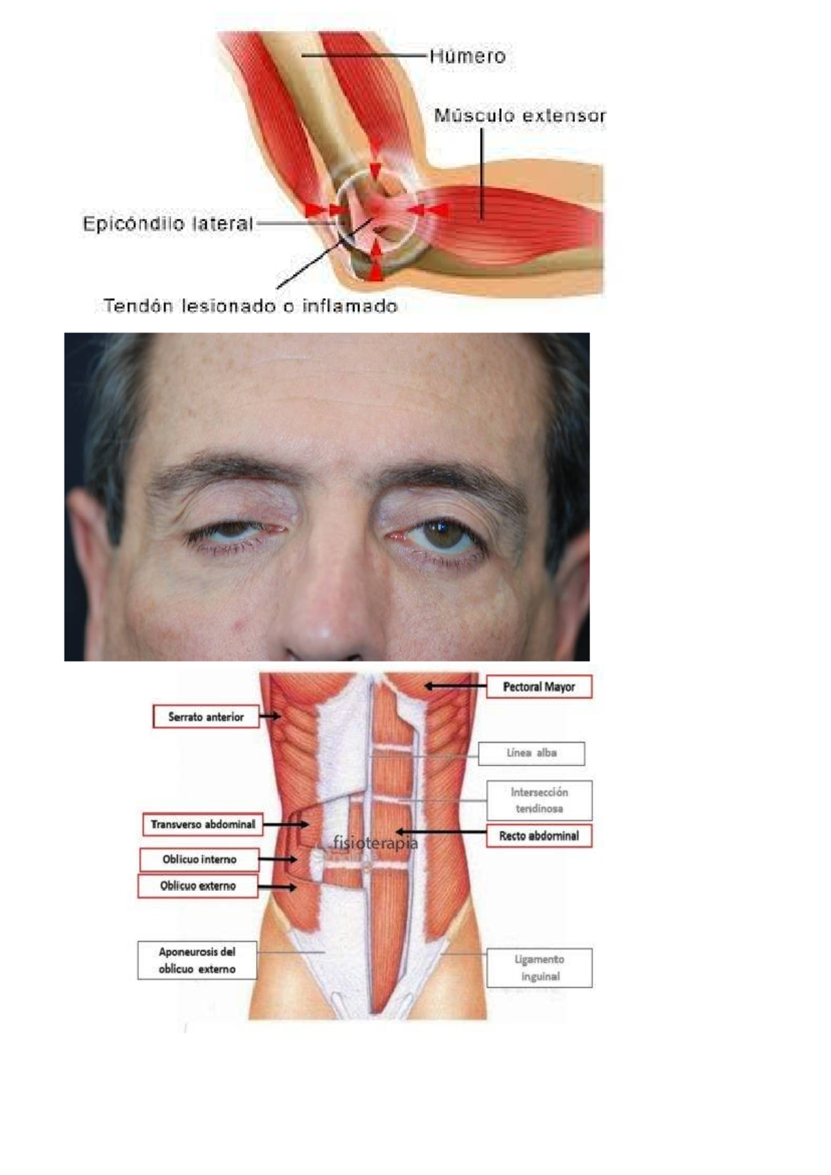 Anatomiaaa - clasee - Músculo extensor Epicóndilo lateral Tendón ...