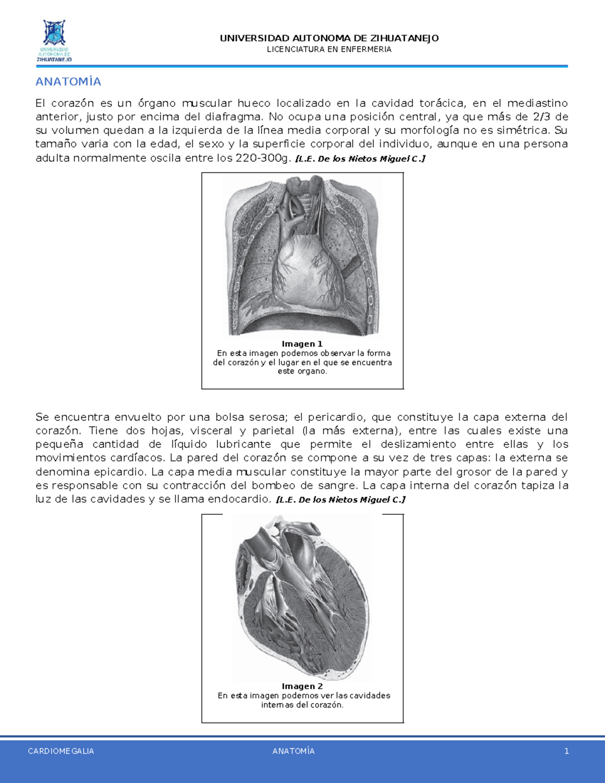 Cardiomegalia - LICENCIATURA EN ENFERMERIA CARDIOMEGALIA ANATOMÍA ...
