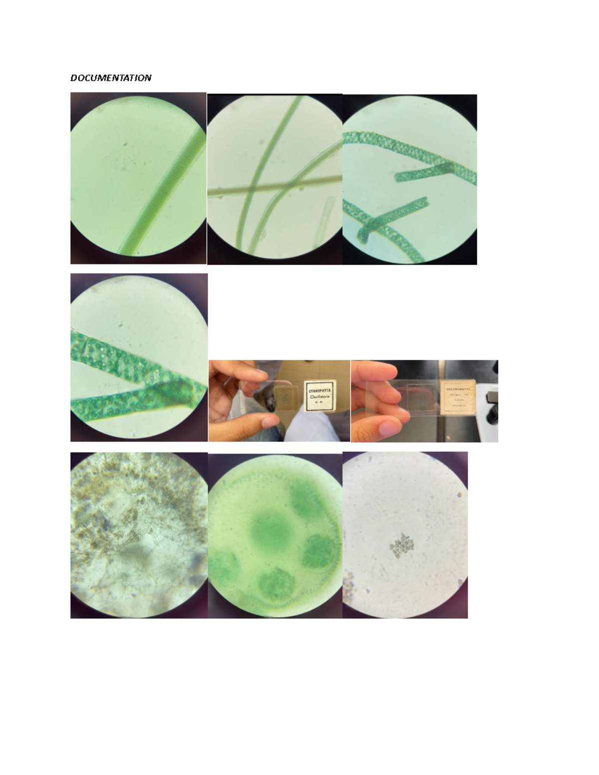 Documentation Micro Para - Microbiology And Parasitology ...