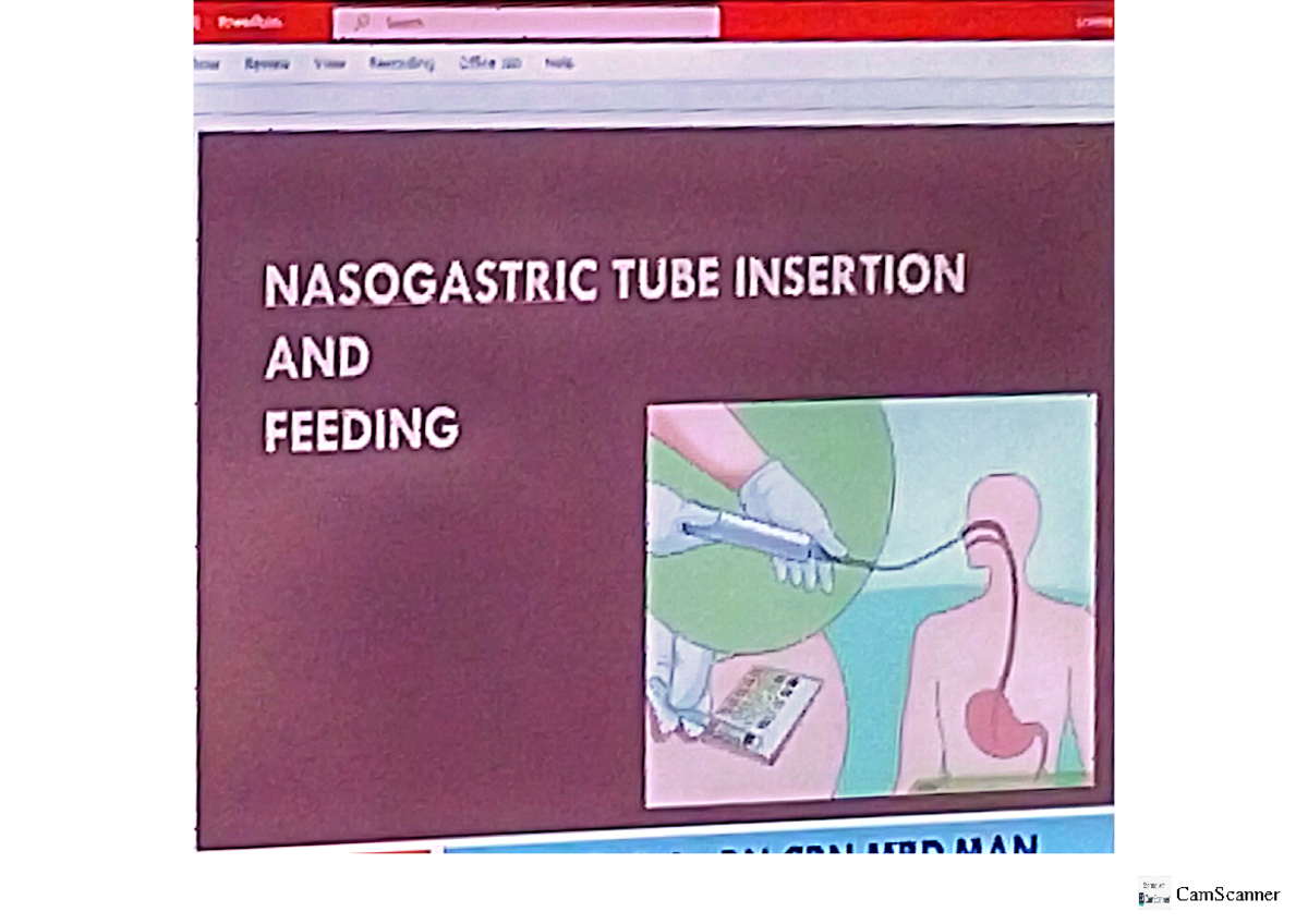 NGT - LESSON ON NASOGASTRIC TUBE - how Revenue Services NASOGASTRIC ...
