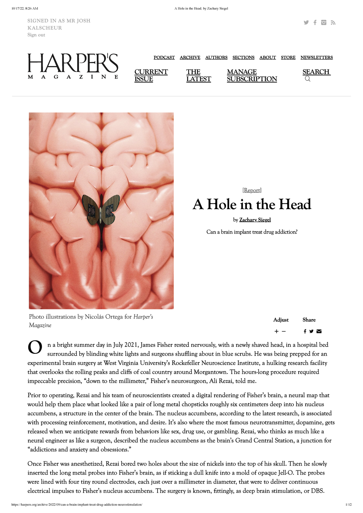 A Hole in the Head, by Zachary Siegel - Sign out SIGNED IN AS MR JOSH K ...