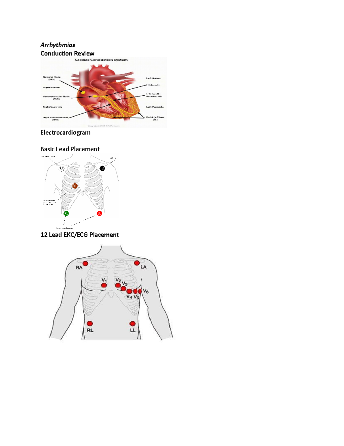 Arrhythmias notes - acls practice - Arrhythmias Conduction Review ...