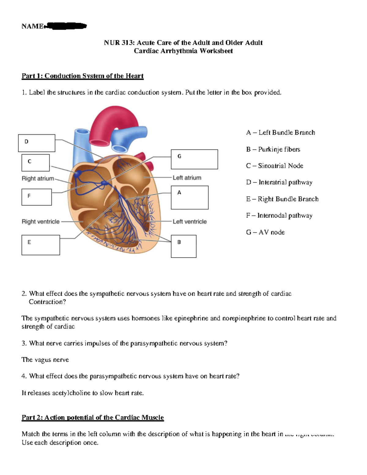 Cardiac Dysrhythmia Worksheet - NAME: Olivia Prue NUR 313: Acute Care ...