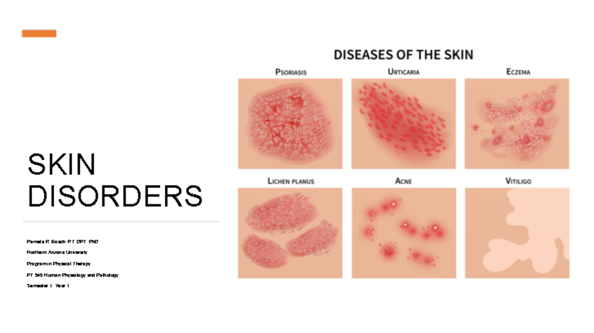 Skin Disorders - Pamela Bosch - SKIN DISORDERS Pamela R. Bosch, PT, DPT ...
