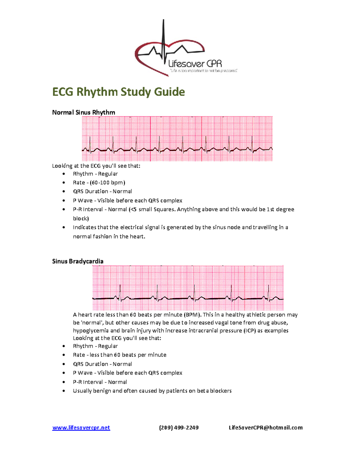 ECG-Rythum-Study-Guide - ECG Rhythm Study Guide Normal Sinus Rhythm ...