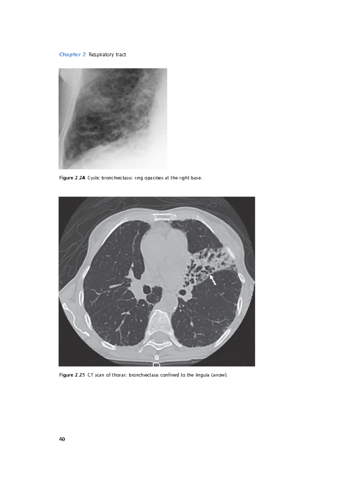 Radiology Lecture Notes pdf (14) - Chapter 2 Respiratory tract 40 ...