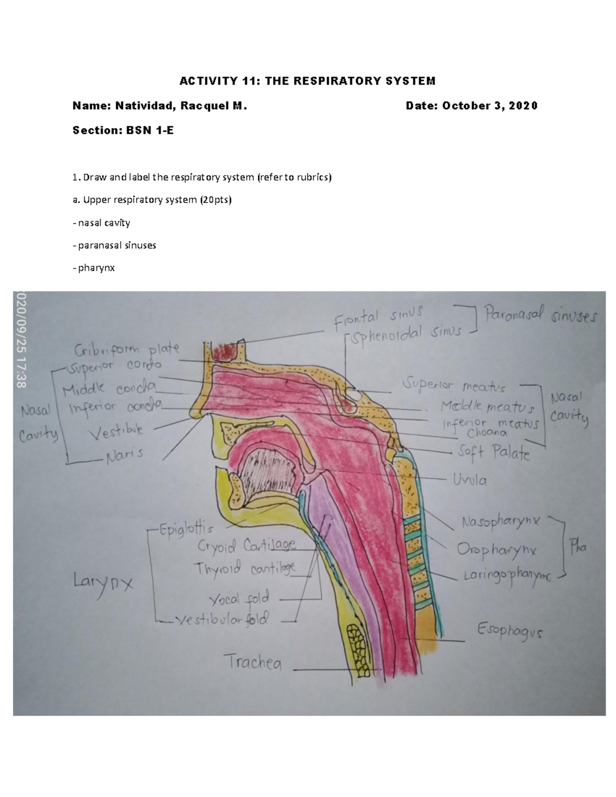 Natividad, Racquel M. Activity 11- Anaphy - ACTIVITY 11: THE ...
